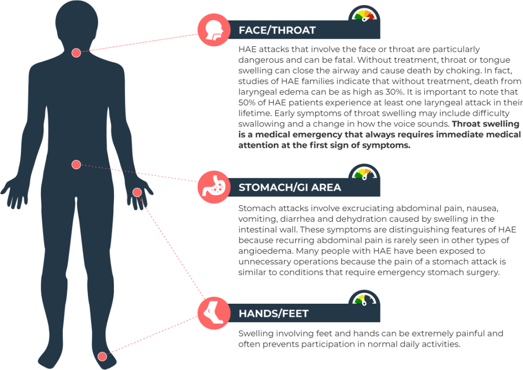 What is Hereditary Angioedema (HAE)? - Avin Darou